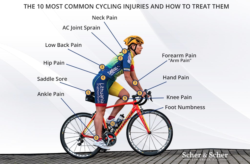 Bicycle Accident Lawyer Hollywood FL | Scher & Scher